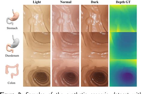 Figure 2 From A Geometry Aware Deep Network For Depth Estimation In Monocular Endoscopy