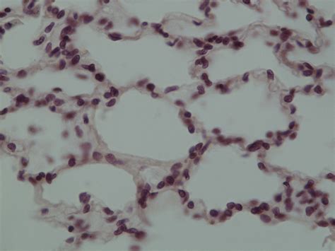 Simple Squamous Epithelial Tissue Slides
