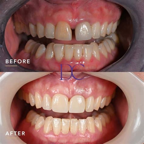 Dentist Near Caroline Springs Dental Couture