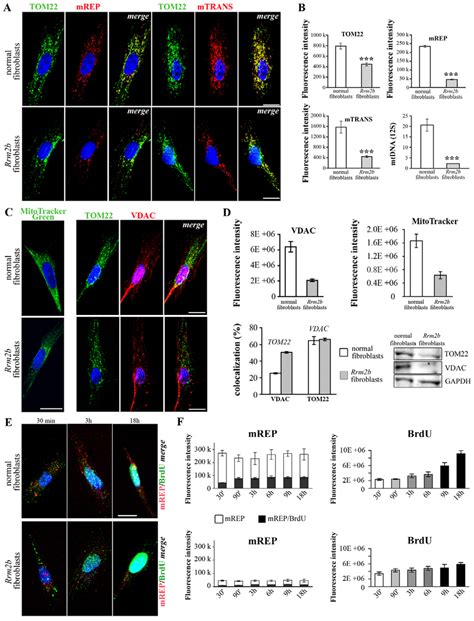 Mtrip Detects Mtdna Processing Alterations In Cells Of A Patient With