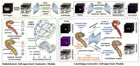 Figure 1 From Generalizable Pancreas Segmentation Via A Dual Self Supervised Learning Framework