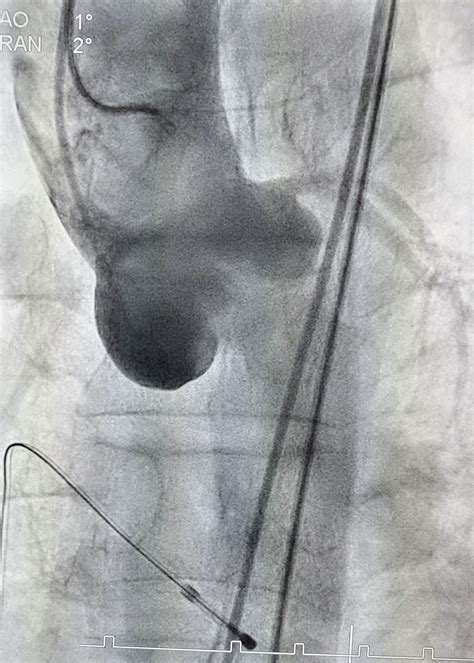 Shaik Masood Mohiddin On Linkedin Aster Dr Dr Evolut