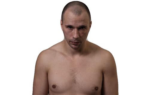 3 anatoly safronov fea md