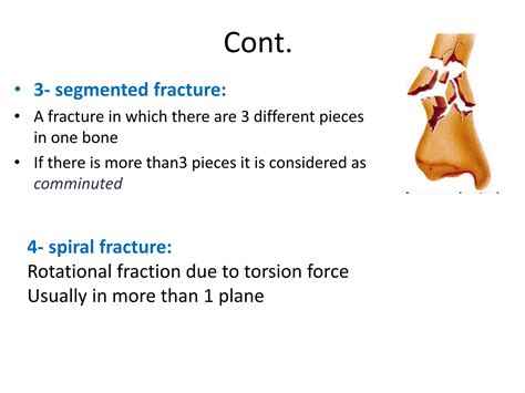 Classification Of Fracture Pptx