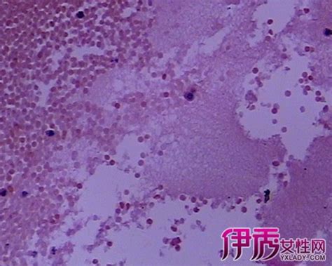血淀粉酶和淀粉酶一样吗 血淀粉酶是查什么的 随意云