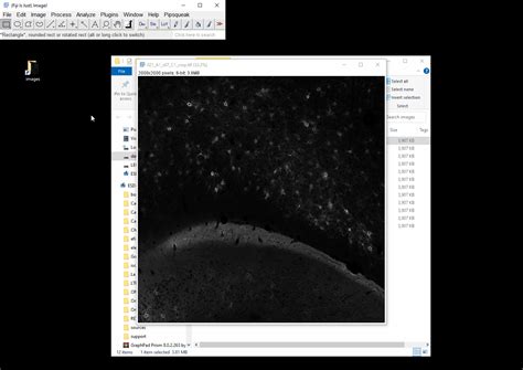Counting Pnns With Imagej Leonardo Lupori