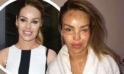 Katie Piper Hospitalised After Husband Saw Black Spot In Eye Tuik