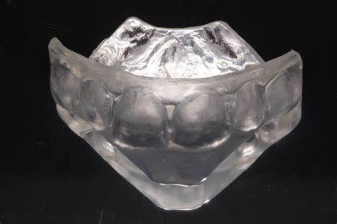 B Splints Everything You Need To Know — Nova Smiles