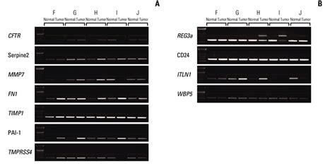 Reverse Transcriptase Polymerase Chain Reaction Was Performed For