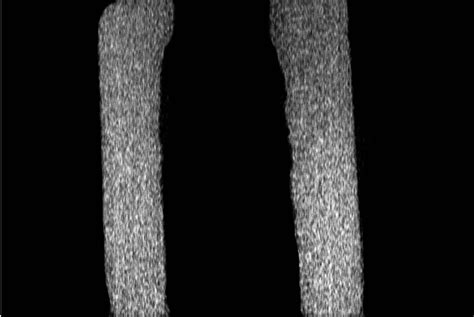 The Vertical Pro Fi Le Reconstructed By T Fdk Algorithm Download Scientific Diagram