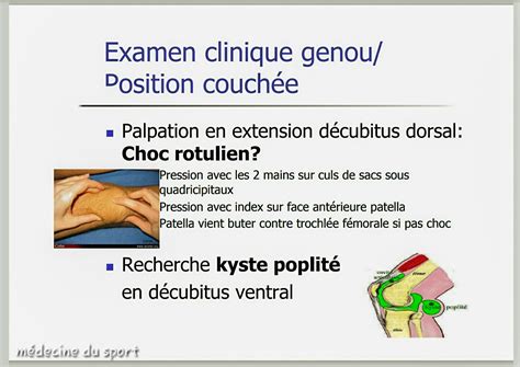 Examen De Genou En Cours De Traitement