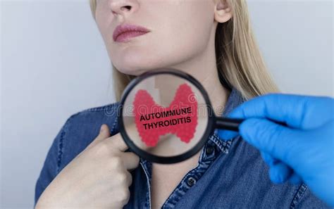 Thyroid Disease Autoimmune Thyroiditis The Doctor Examines The