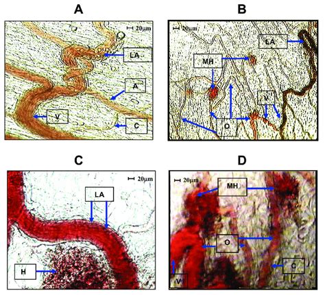 Mesenteric Microcirculation Injuries Following 2 H Of Bacterial Download Scientific Diagram