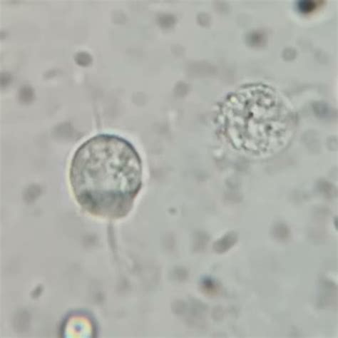 Trichomonas Vaginalis Under Microscopy 100× Urine Sample Youtube