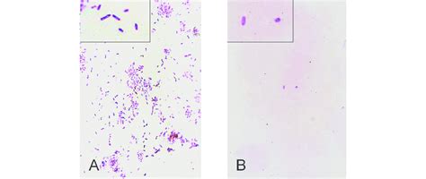 Gram Staining Staphylococcus Aureus And Pseudomonas Fluorescens Hot