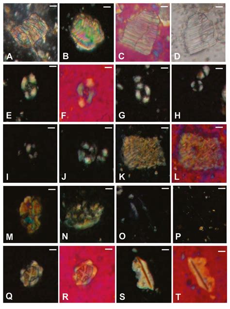 Calcareous Nannofossils From The Kamar E Mehdi Section Xpl Cross