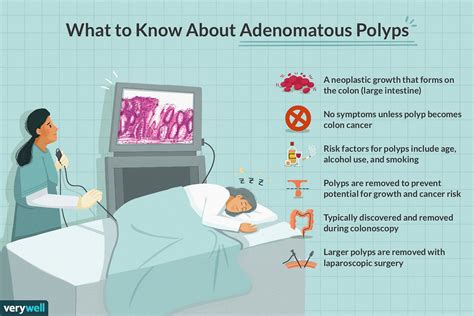 Adenomatous Polyp Symptoms Causes Diagnosis And Treatment