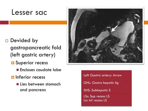 Ppt Fascia Of The Abdomen Powerpoint Presentation Free Download Id 1978915