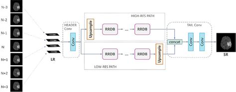Modified Structures Of The Generator Of Mri‐based Brain Tumor Download Scientific Diagram