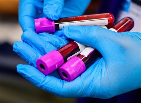 Laboratory Specimen Collection With Primary Care Mary Berglund Community Health Centre Hub