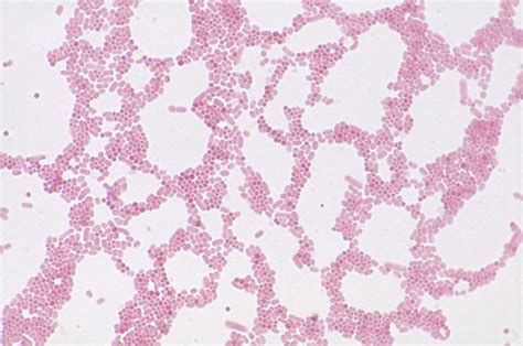 Escherichia Coli And Staph Aureus Photograph By Michael Abbey Pixels