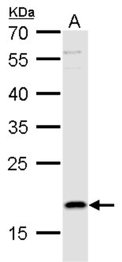 Tslp Polyclonal Antibody Pa5 85586