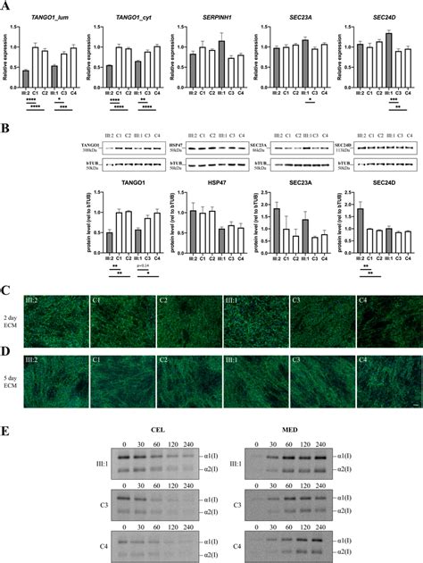 Variant Characterization In Fibroblasts Of Heterozygous Carriers Download Scientific Diagram