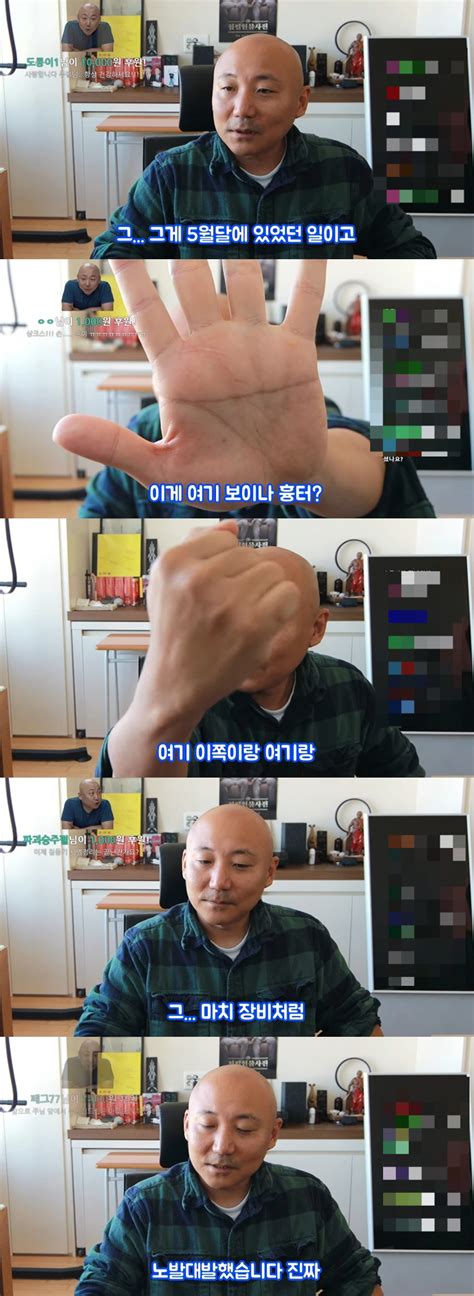 강도 피해 주호민 양손에 남은 흉터 기안84도 노발대발 [종합]