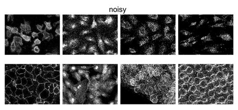 Github Mouselandcellpose A Generalist Algorithm For Cellular