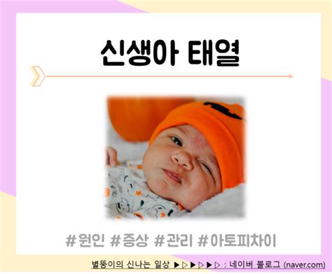 신생아 태열 원인 증상 관리 아기태열 아토피 차이 및 치료방법 네이버 블로그