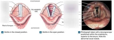 Glottisdiagramm