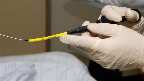 Endoscopic Biopsy Of Lung At Deborah Vann Blog