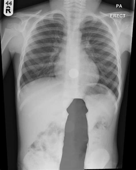 The X Ray Kent S New Archiv