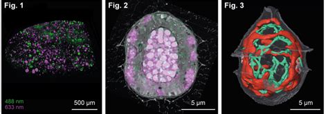 Targeted Vclem Of Heterogeneous Samples Focalplane