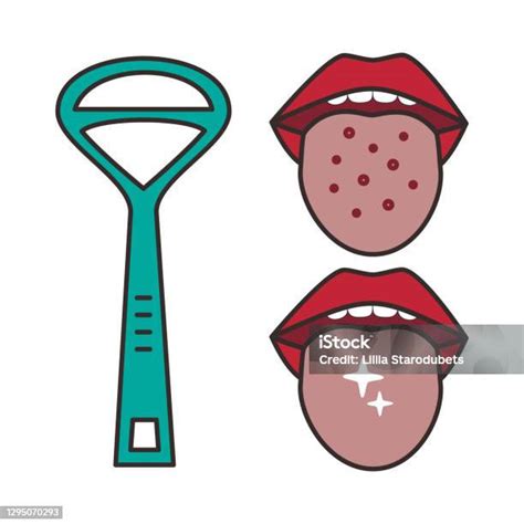 혀 위생의 벡터 일러스트 혀 클리너 흰색으로 고립 된 더럽고 깨끗한 혀 치과 치료 구강 위생 및 치과 절차 개념 플랫 스타일 0명에 대한 스톡 벡터 아트 및 기타 이미지