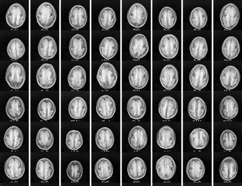 Automated Kernel Shrivel Detection Of Walnuts In Shell Instruments