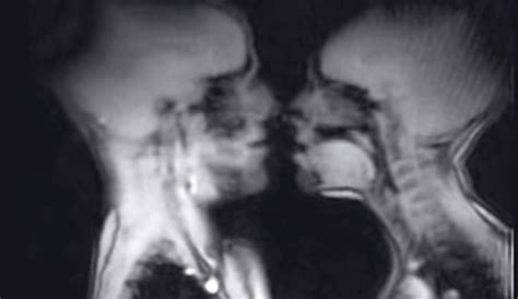 This Is What Sex Looks Like Inside An Mri Scanner Nsfw Video
