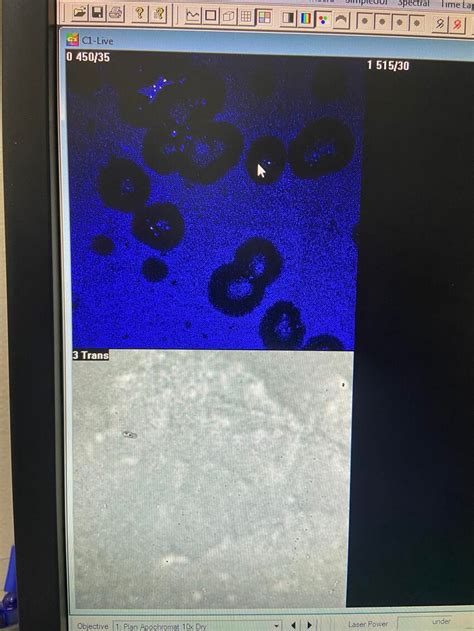 Dapi Staining Background Too Bright Researchgate