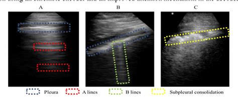 Unsupervised Multi Latent Space Reinforcement Learning Framework For Video Summarization In