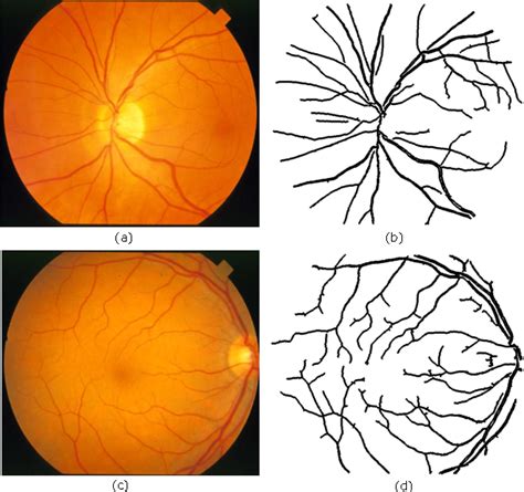 Phase Stretch Transform Semantic Scholar
