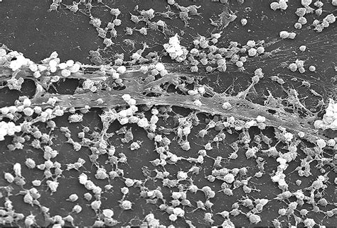 Free Picture Biofilm Formation Lumen Indwelling Catheter Secreted