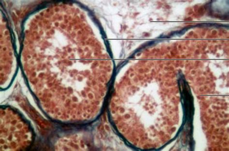 Histology Slides Biol 320 Flashcards Quizlet