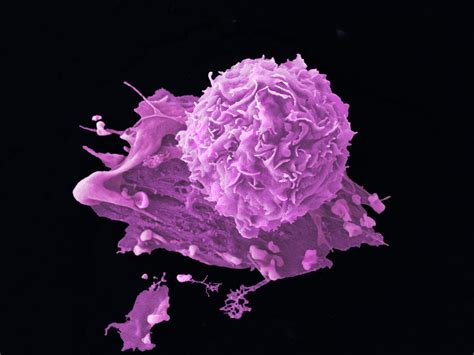 Exploding Cancer Cells Scientists Discover New Way To Combat The Disease The Independent