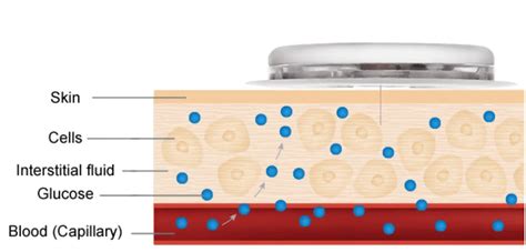 Cgm Design And Key Usage Details Transmission Insertion Placement A Suswel