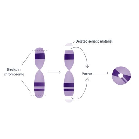 Ring Chromosomes Ring20 Research And Support Uk Cio