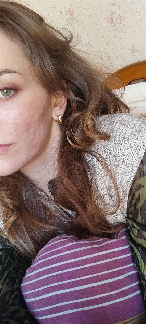 Cicatrici Da Acne Brad Pitt Sette Foto Quiz Brad Pitt