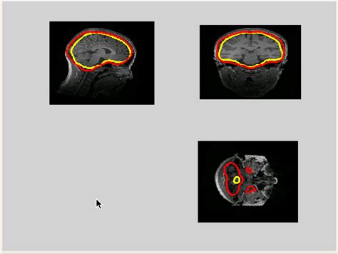 Template Models For Source Reconstruction Fieldtrip Toolbox