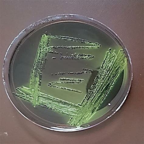 Positive Growth Li On Emb Agar Download Scientific Diagram