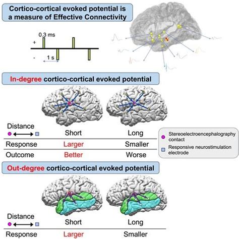 Effective Connectivity Relates Seizure Outcome To Electrode Placement