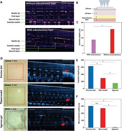 Insertion Of Microneedle Patches Into Different Tissue Models Including